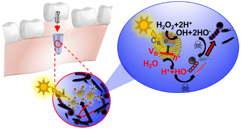 Swarming Magnetic Photoactive Microrobots for Dental Implant Biofilm ...